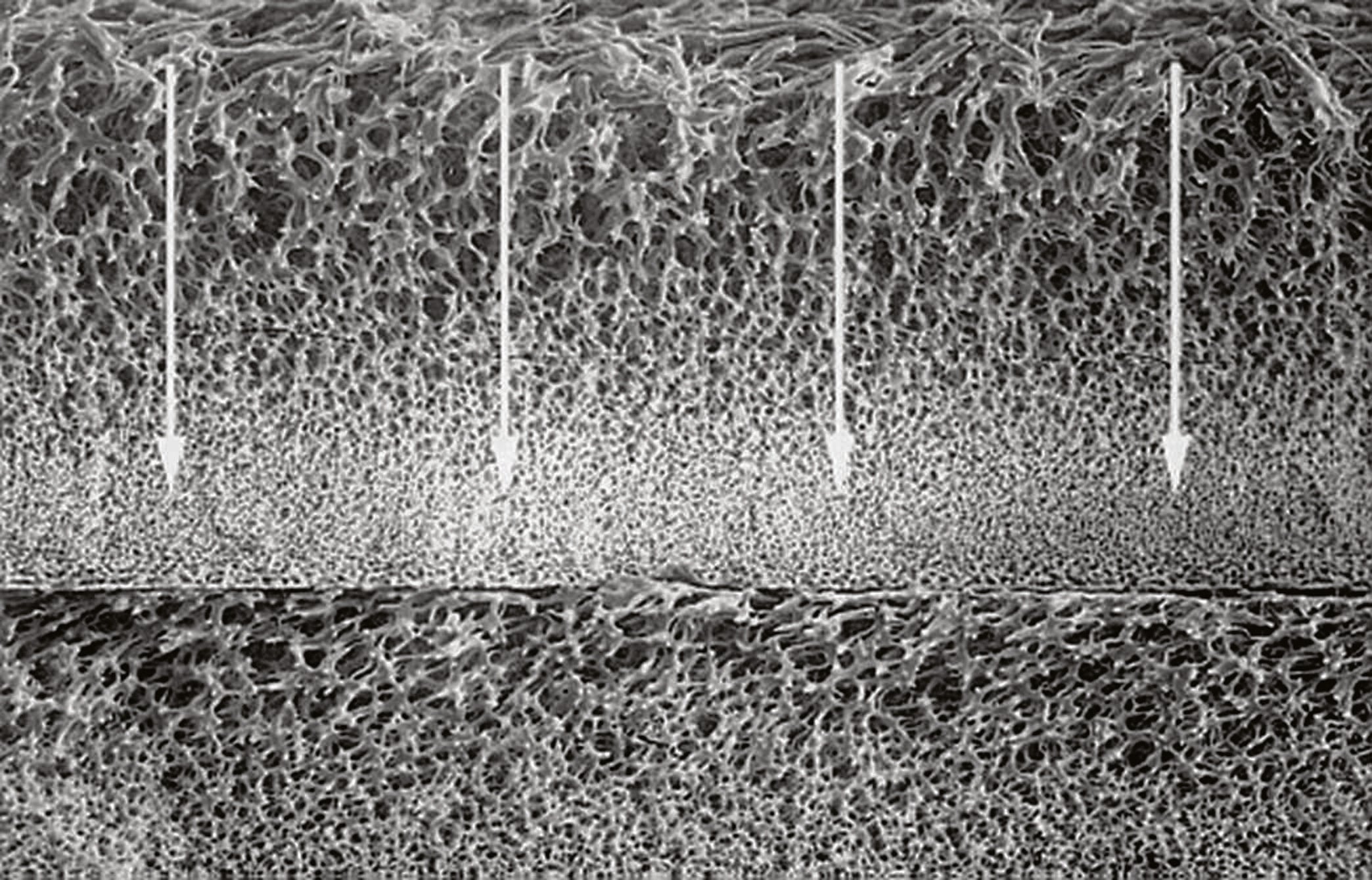 Blood Separation Membranes